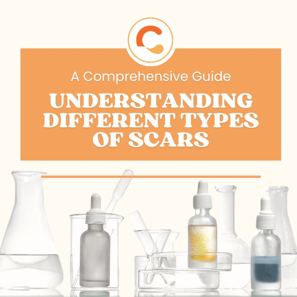 Understanding Different Types of Scars: A Comprehensive Guide ...